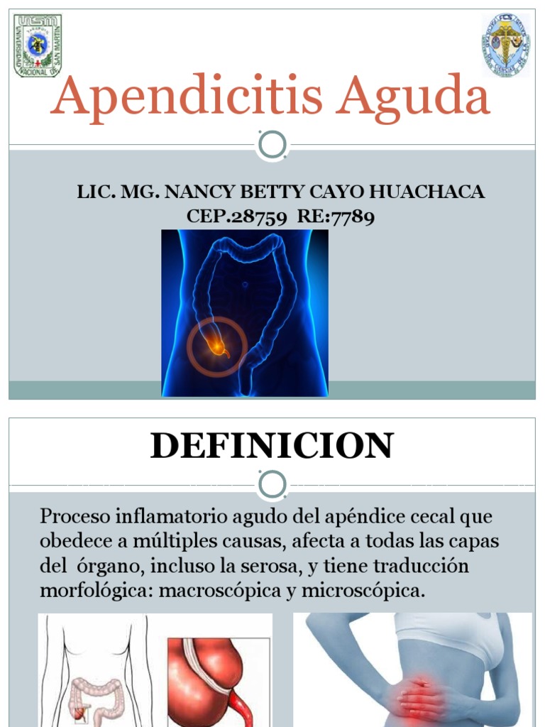 Apendicitis Aguda | Medicina CLINICA | Gastroenterología