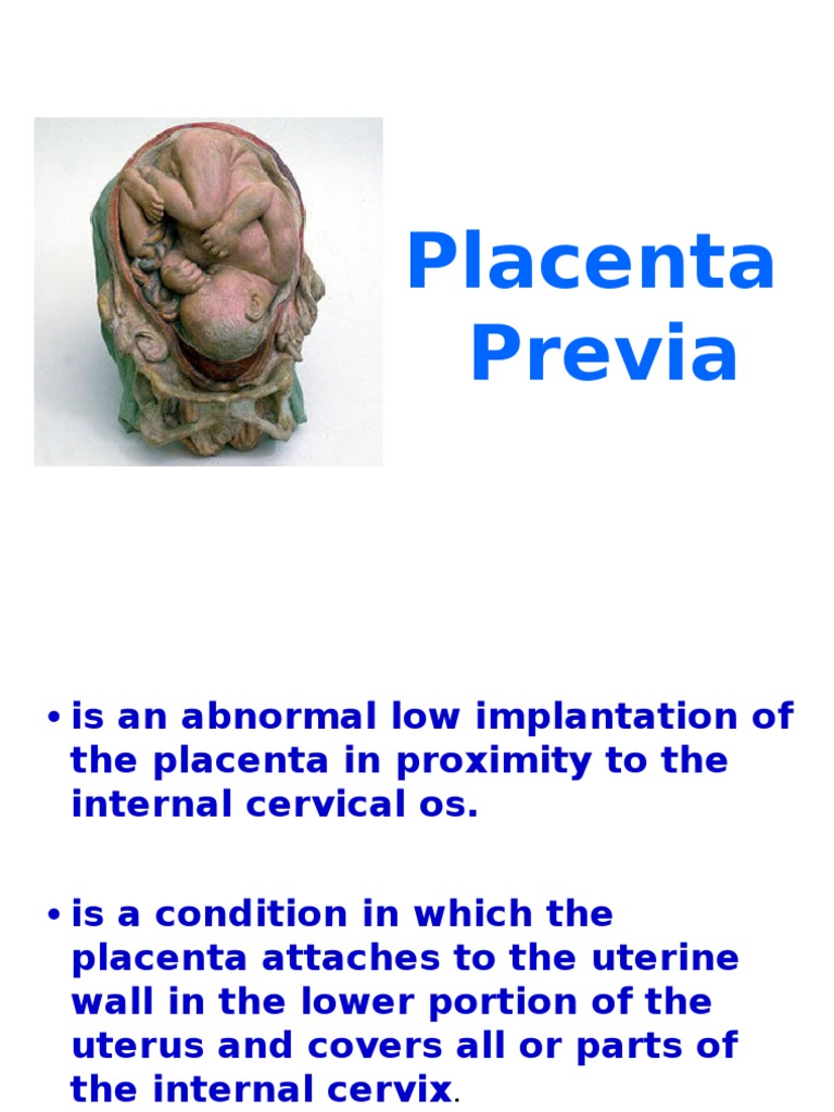 Placenta Previa (No Animation) | PDF