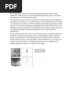 Manejo de Coprostasis en Pediatría Completa | PDF | Recto | Diarrea