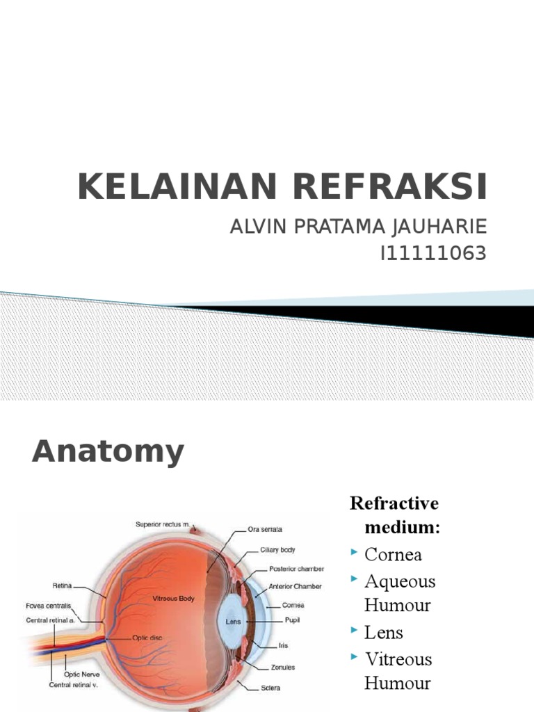 Kelainan Refraksi | PDF | Lens (Optics) | Human Eye