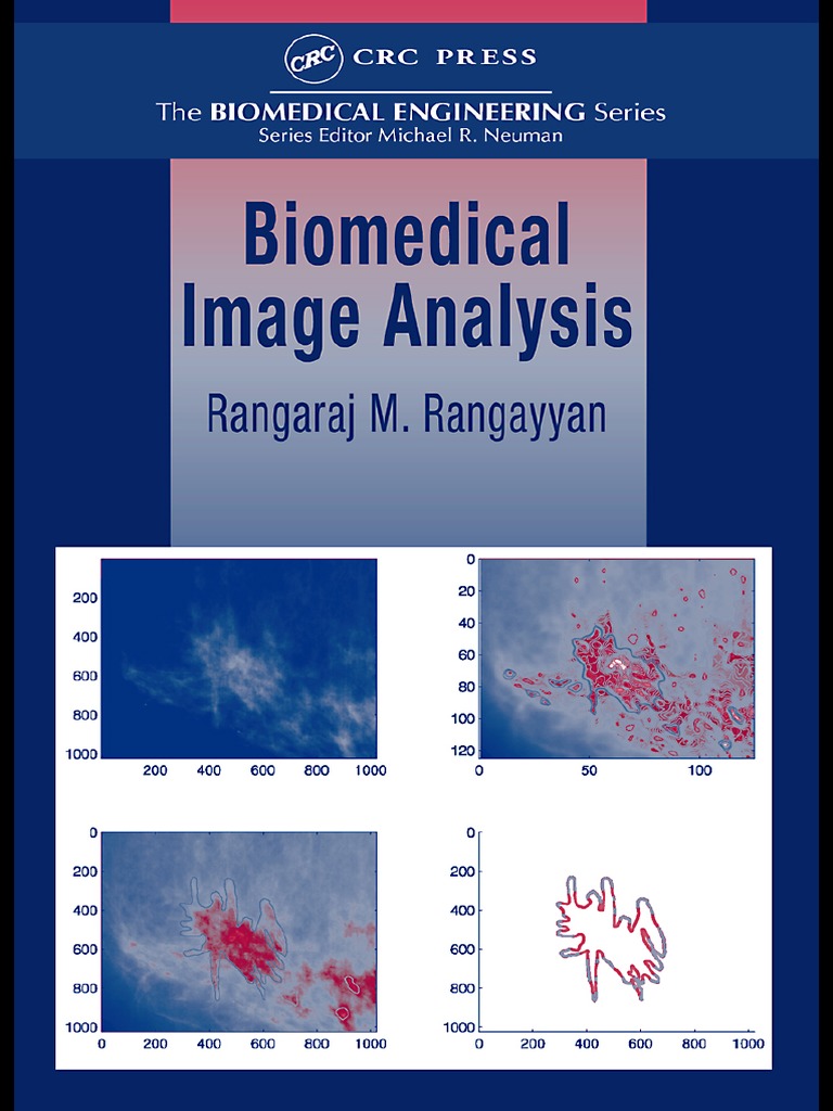 Rangayyan R. Biomedical Image Analysis (CRC, 2005) (ISBN 0849396956 ...