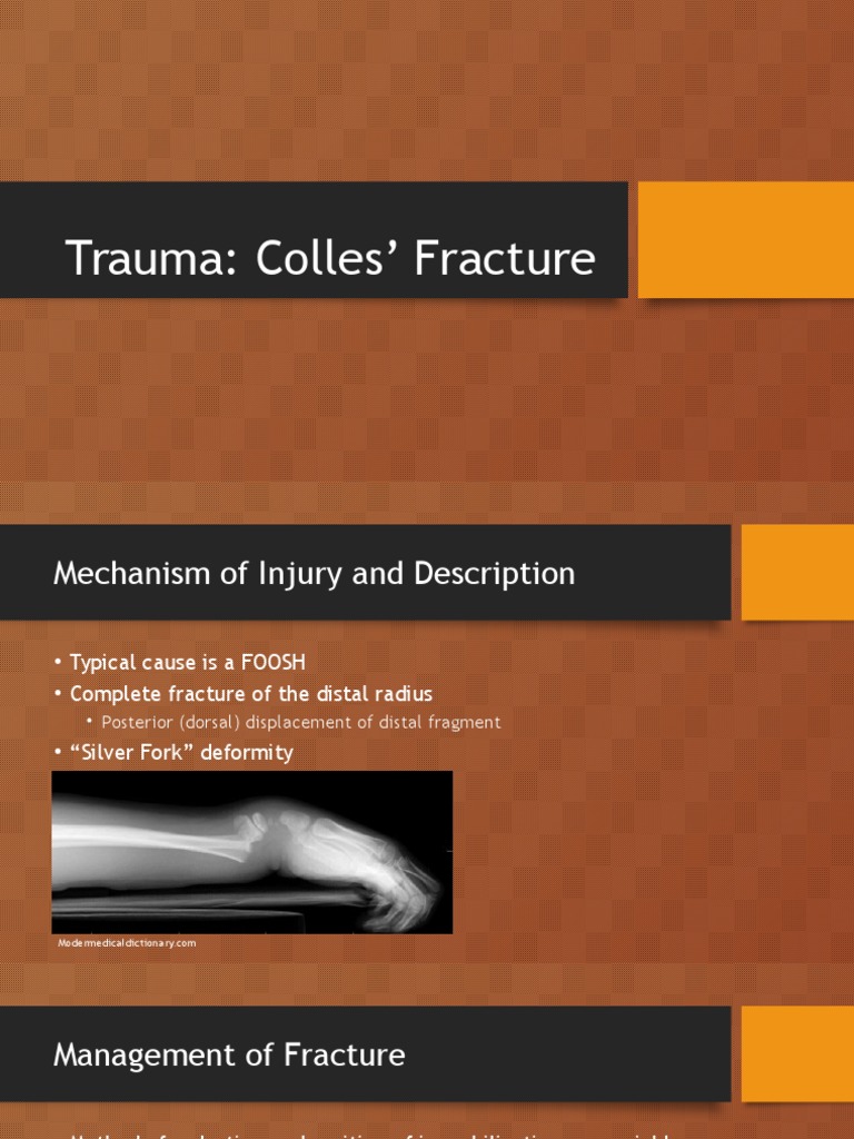 Colles' Fracture: Causes & Management | PDF | History