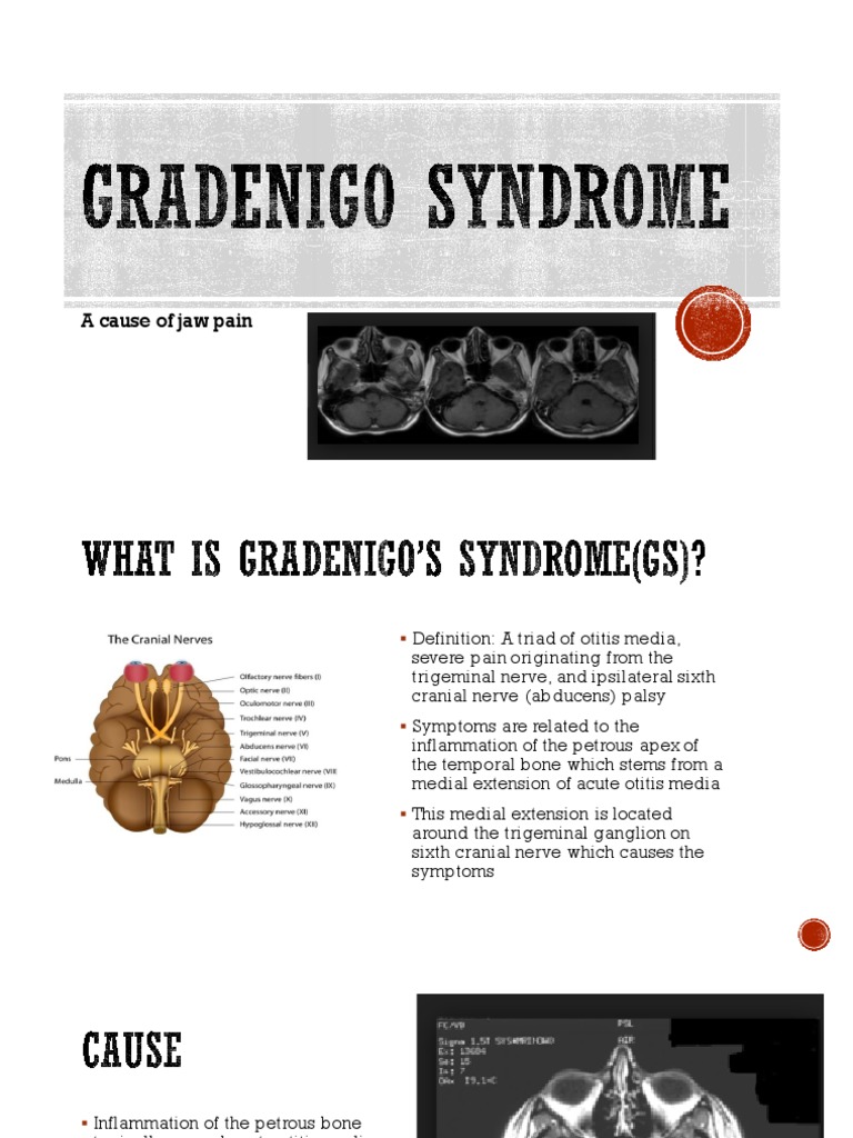 Gradenigo Syndrome | PDF | Medical Specialties | Diseases And Disorders