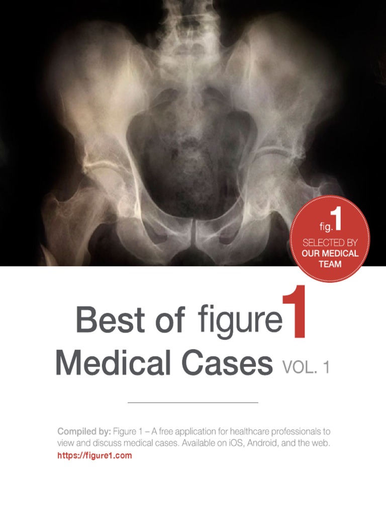 Best of Figure 1 Medical Cases Vol 1 | PDF | Health Sciences | Diseases ...