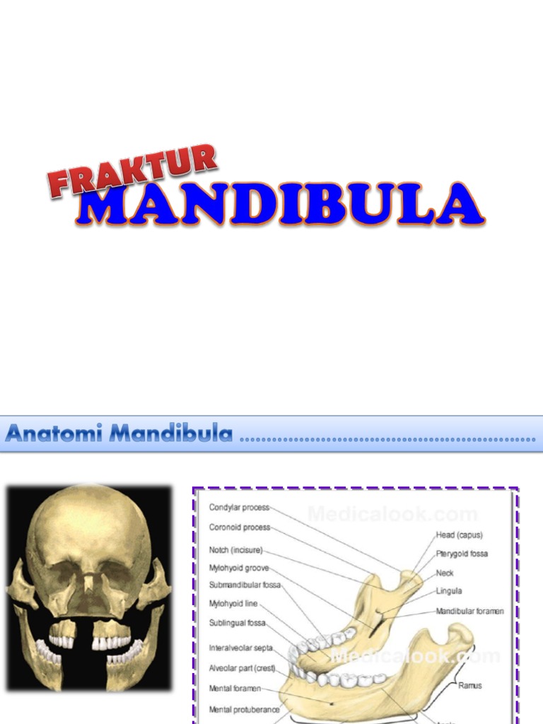 Klasifikasi dan Penanganan Fraktur Mandibula | PDF | Sains & Matematika
