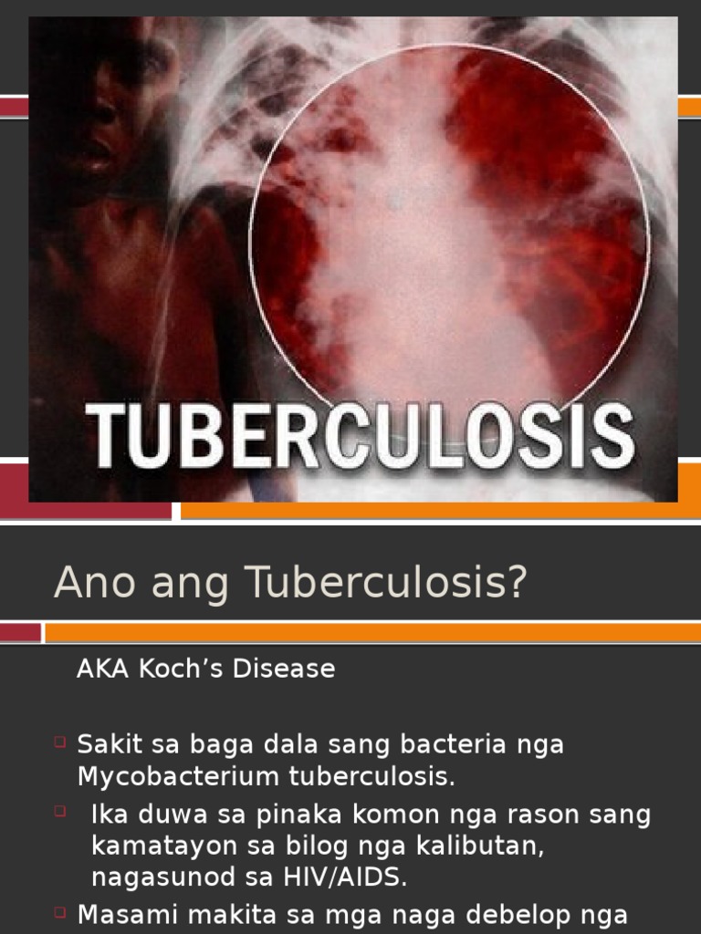 Tuberculosis Lecture | PDF