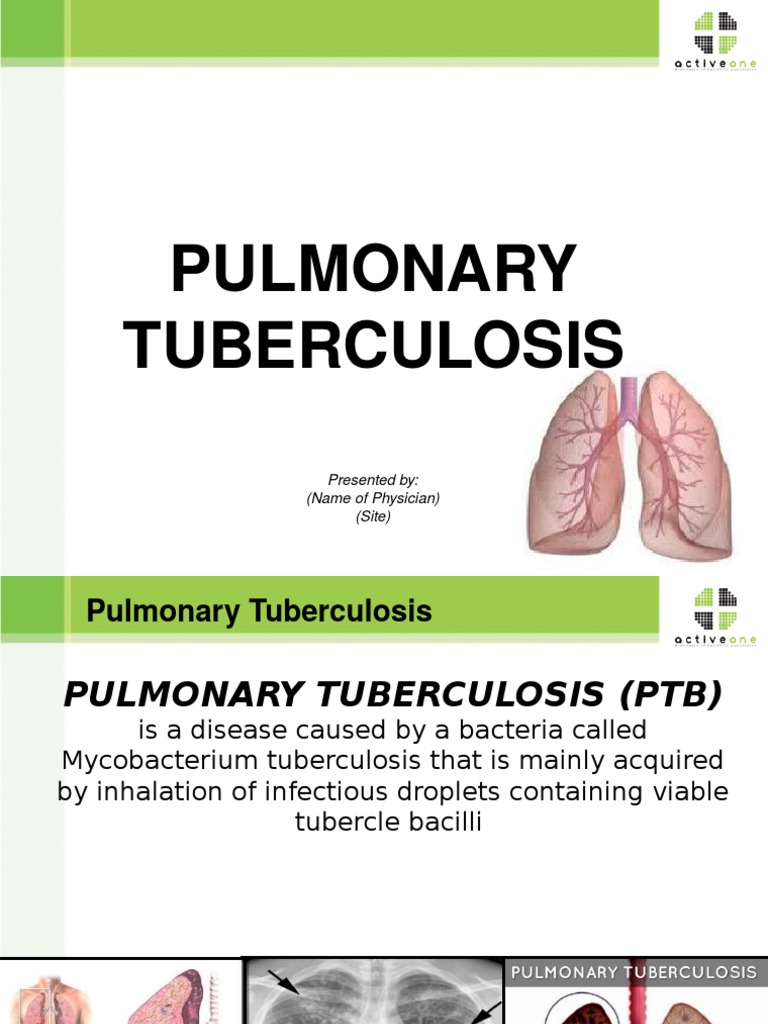 Pulmonary Tuberculosis 2016 | PDF | Tuberculosis | Infection