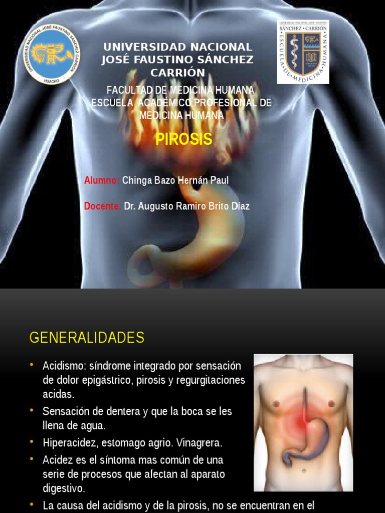 Pirosis: Causas y Tratamientos | PDF | Acidez | Especialidades Medicas