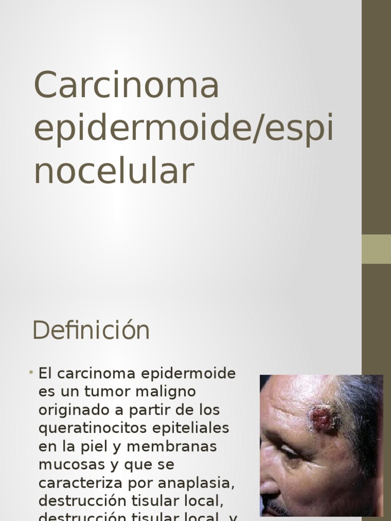 Carcinoma Epidermoide: Tratamiento y Tipos | PDF | Cáncer | Apoptosis