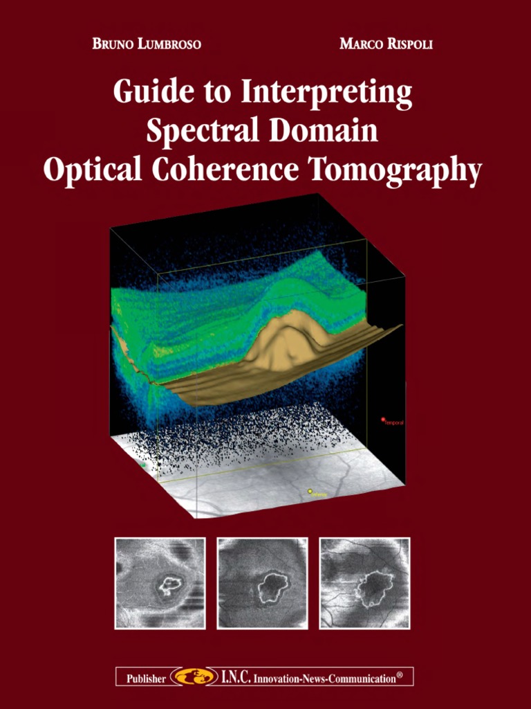 OCT Guide To Interpreting PDF | PDF | Retina | Vision