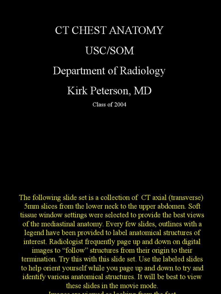 Chest CT Anatomy | PDF | Atrium (Heart) | Aorta