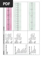 Pac PJC PVC | PDF | Cardiac Electrophysiology | Cardiac Arrhythmia