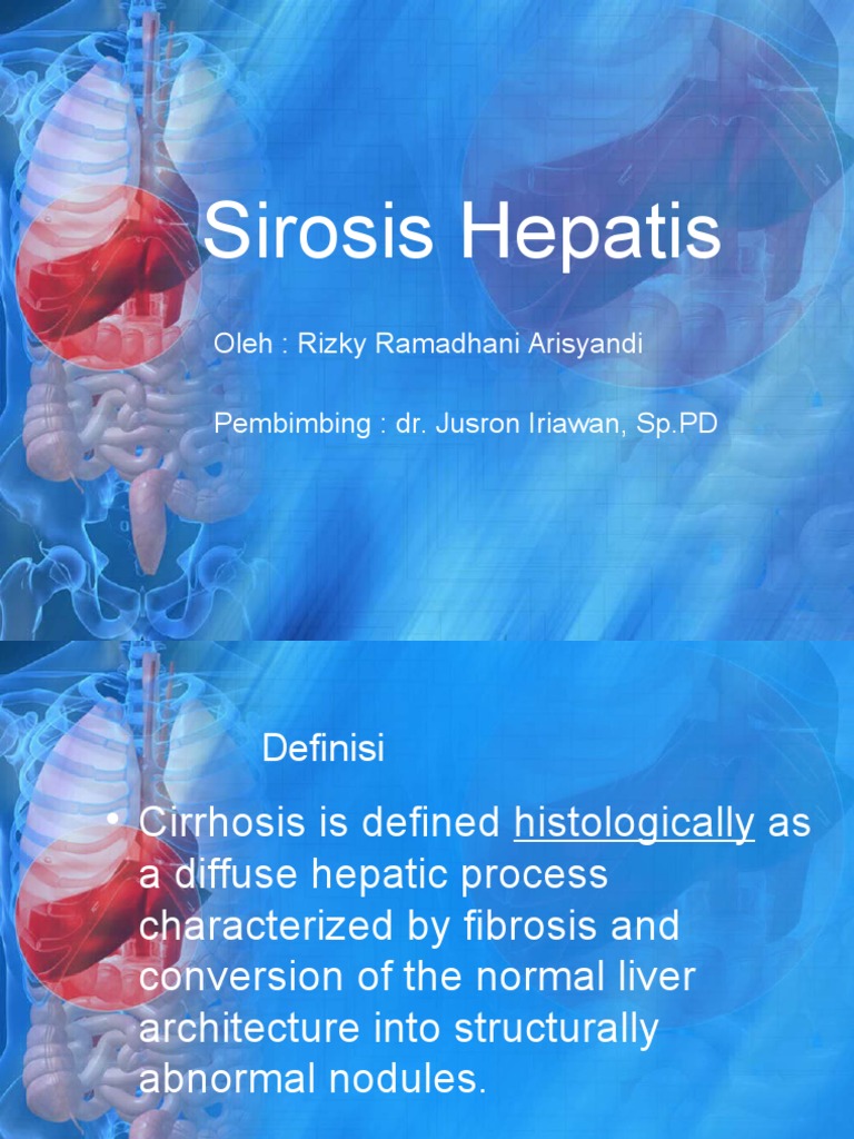 Kasus Sirosis Hati | PDF
