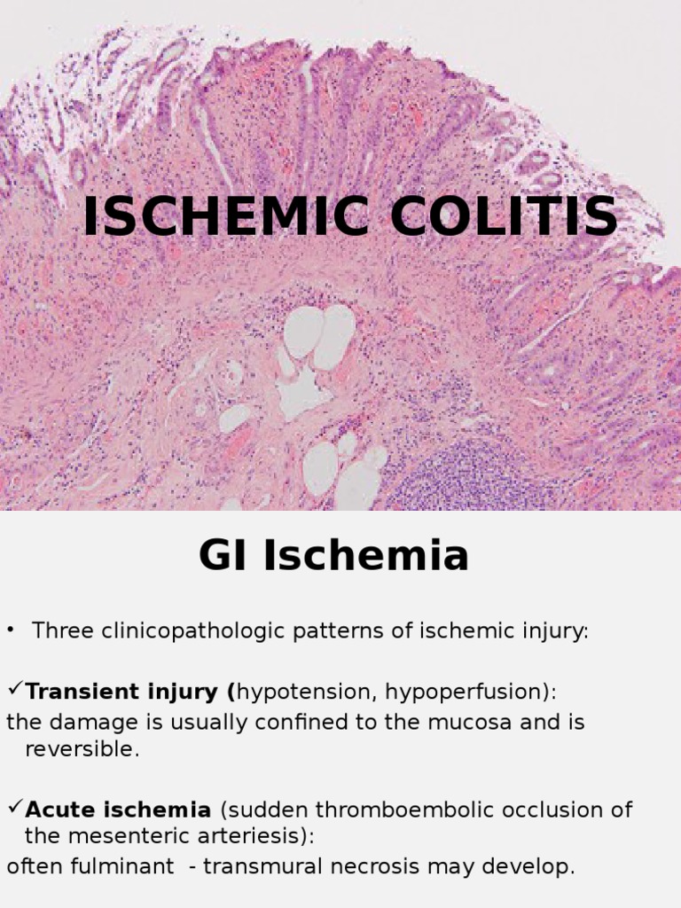 Ischemic Colitis | PDF | Ischemia | Anatomy