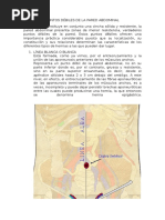 Incisión Rocky Davis | PDF | Medicina CLINICA | Anatomía