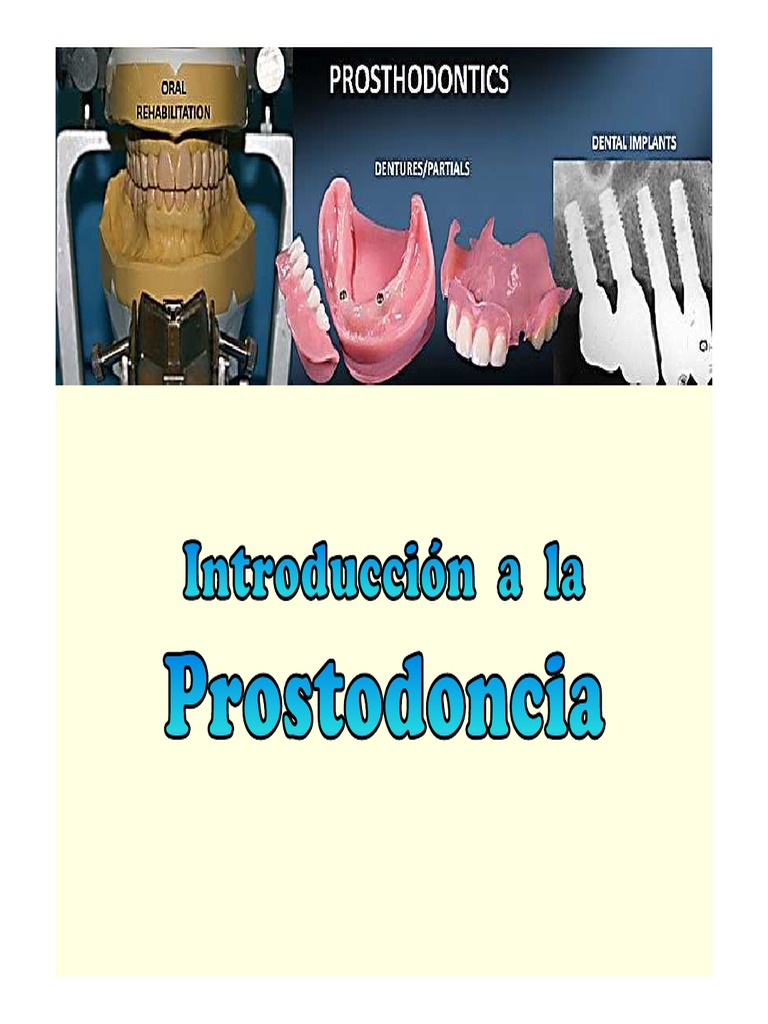 Introducción A La Prostodoncia Fija | PDF | Dentadura postiza | Diente ...