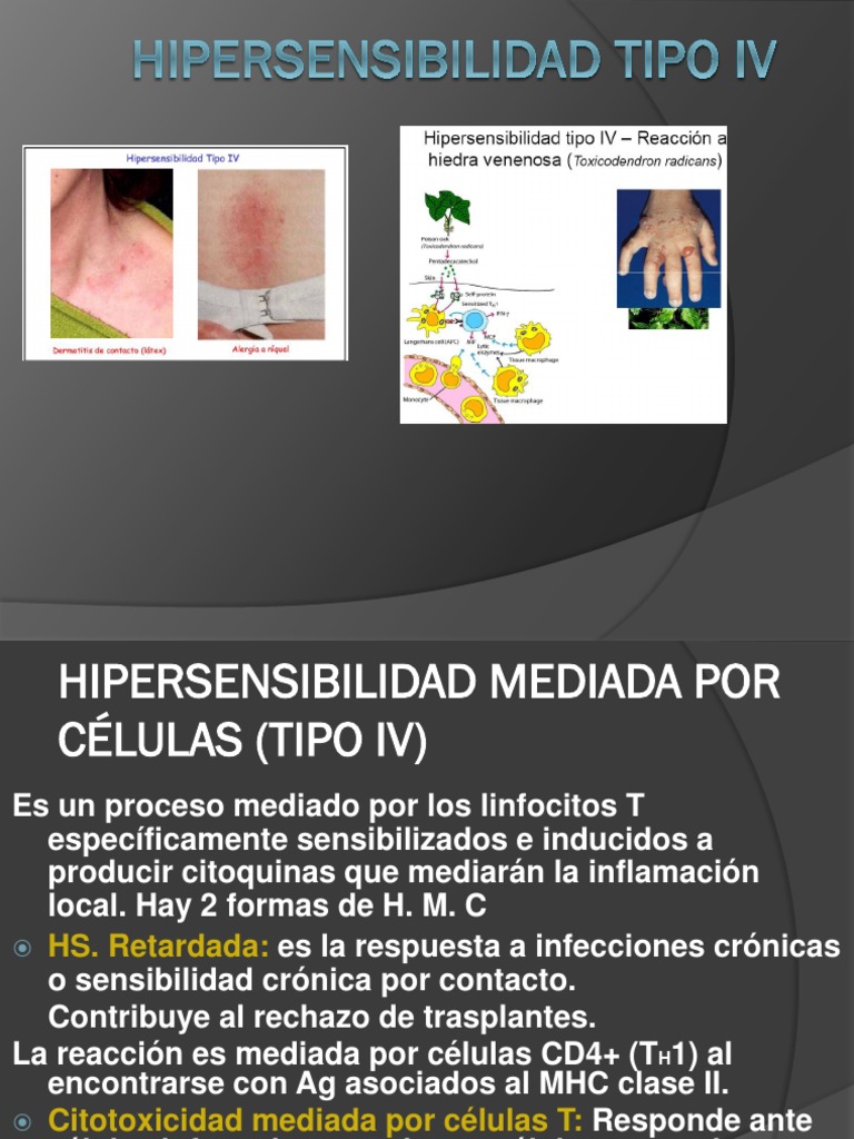 Hipersensibilidad (Tipo IV) | PDF | Célula T | Linfocitos