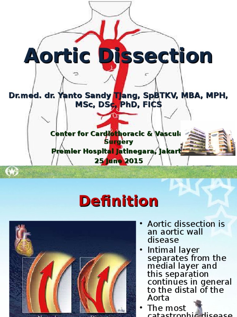 Aortic Dissection Overview and Treatment | PDF | Medical Specialties ...