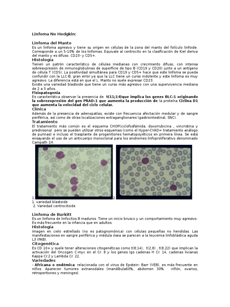 Linfoma No Hodgkin Kevin Goad | PDF | Linfoma | Linfocitos