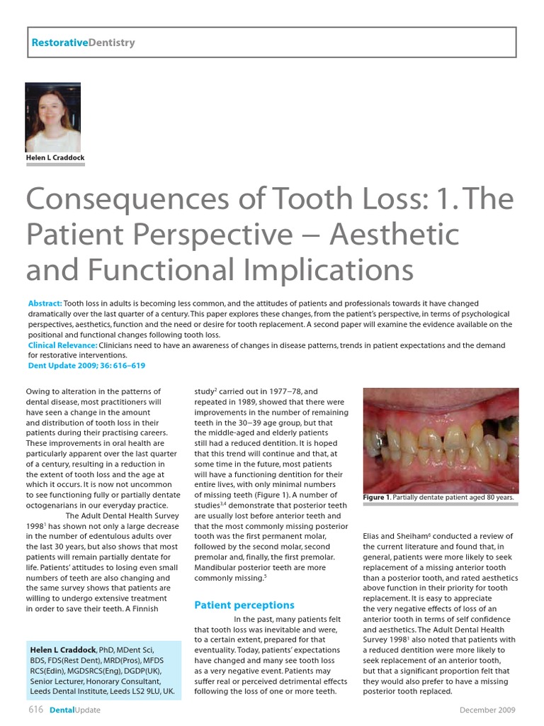 Dental Update 2009. Consequences of Tooth Loss 1. The Patient ...