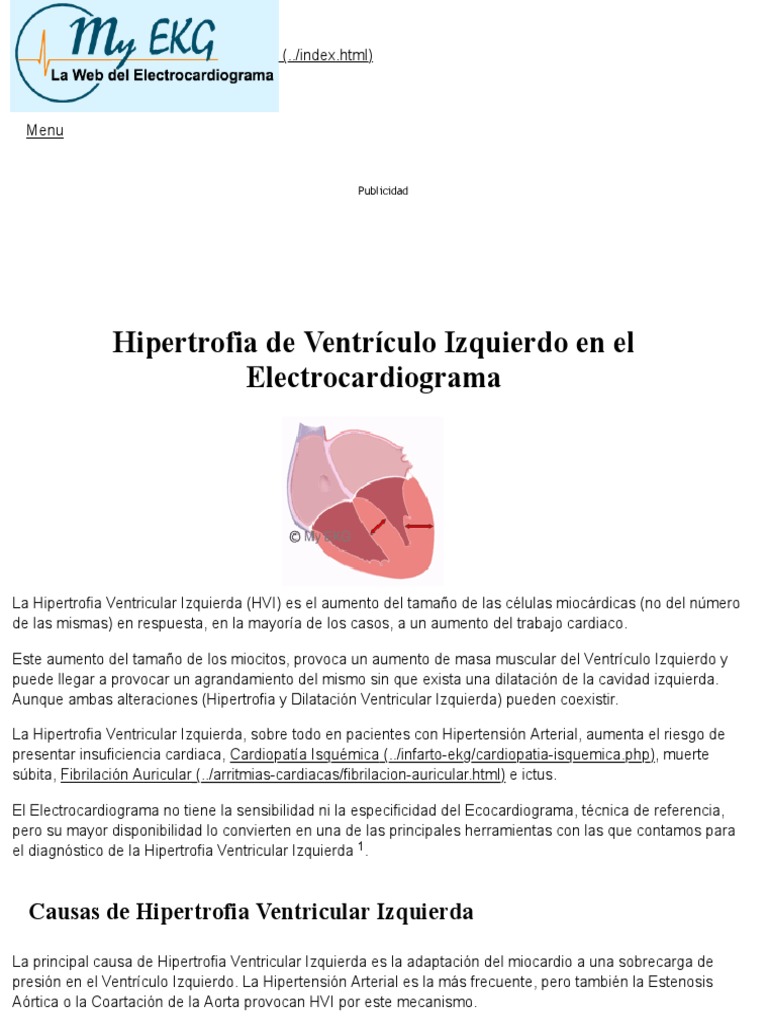 Hipertrofia Ventricular Izquierda | Electrocardiografia | Sistema ...