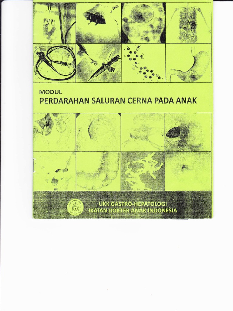 Perdarahan Saluran Cerna Atas | PDF
