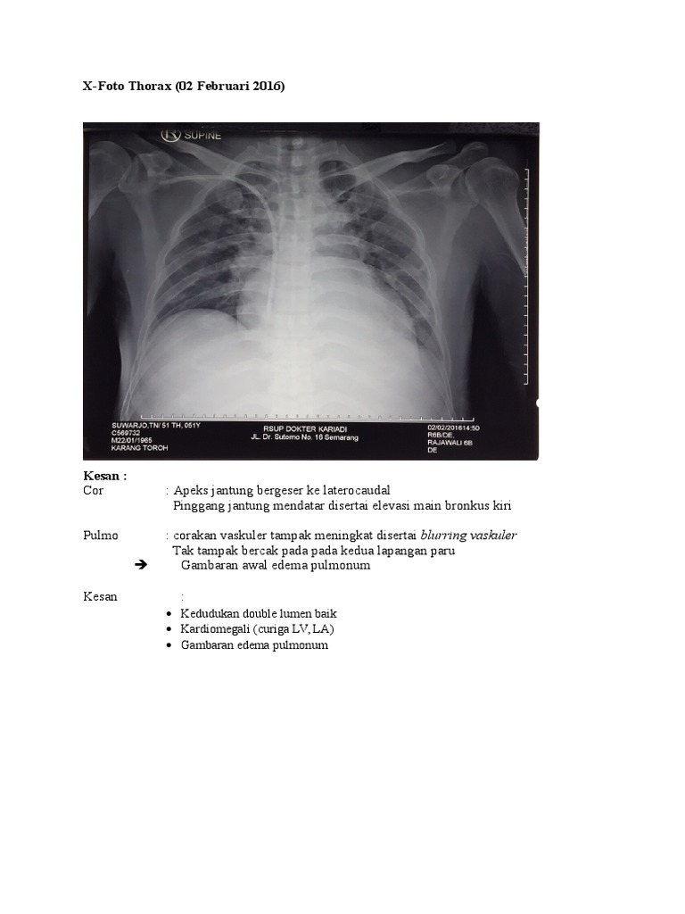 Foto Thorax CKD | PDF