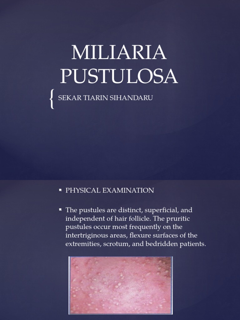 Miliaria Pustulosa TB | PDF | Griya & Taman