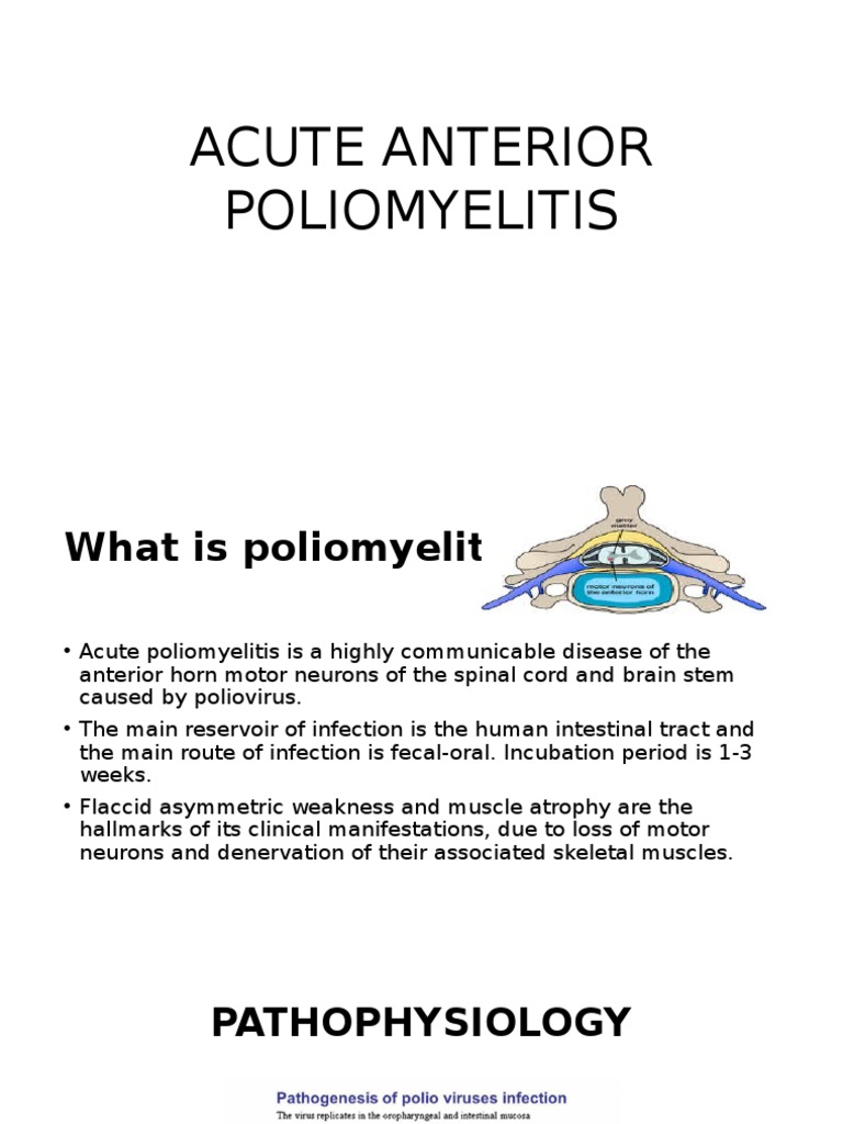 Acute Anterior Poliomyelitis Overview | PDF | Science & Mathematics