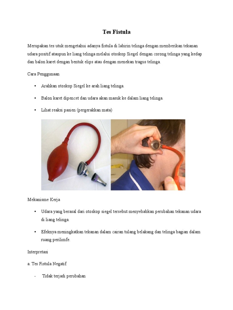 Tes Fistula | PDF