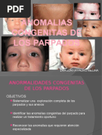 Tecnica Faco+lio+vitrectomia+retinopexia | PDF | Catarata | Oftalmología