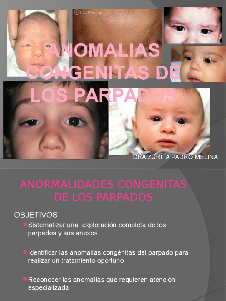 Anomalias de Parpados y Ptosis | PDF | Oftalmología | Enfermedades del ...