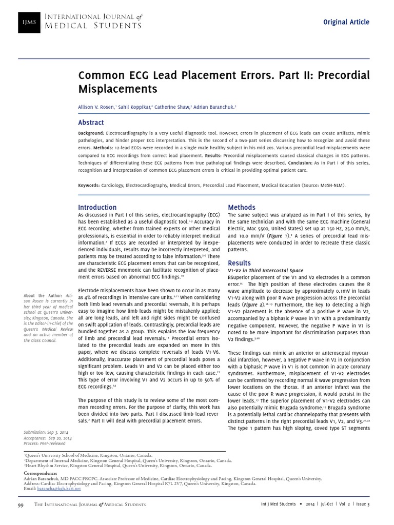 Common ECG Lead Placement Errors. Part II: Precordial Misplacements ...