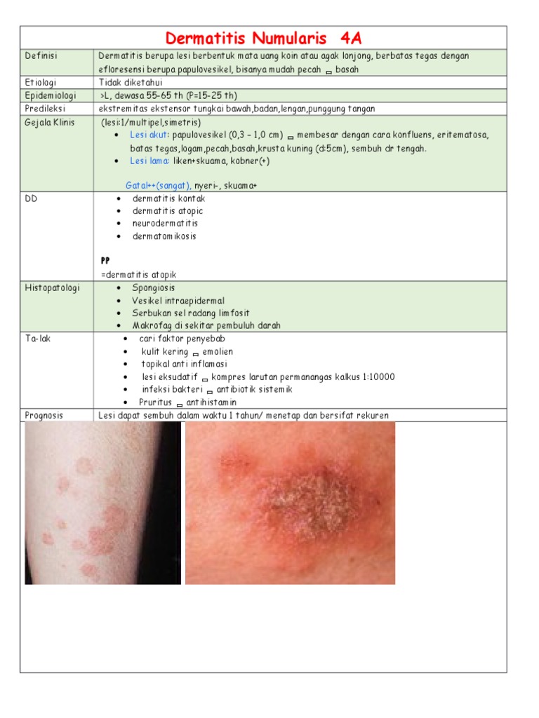 Panduan Lengkap Dermatitis Numularis dan Atopik | PDF