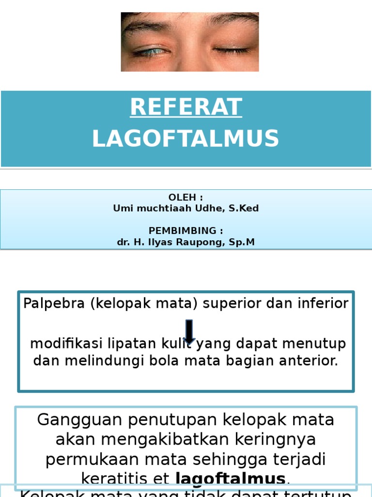 Lagoftalmus | PDF