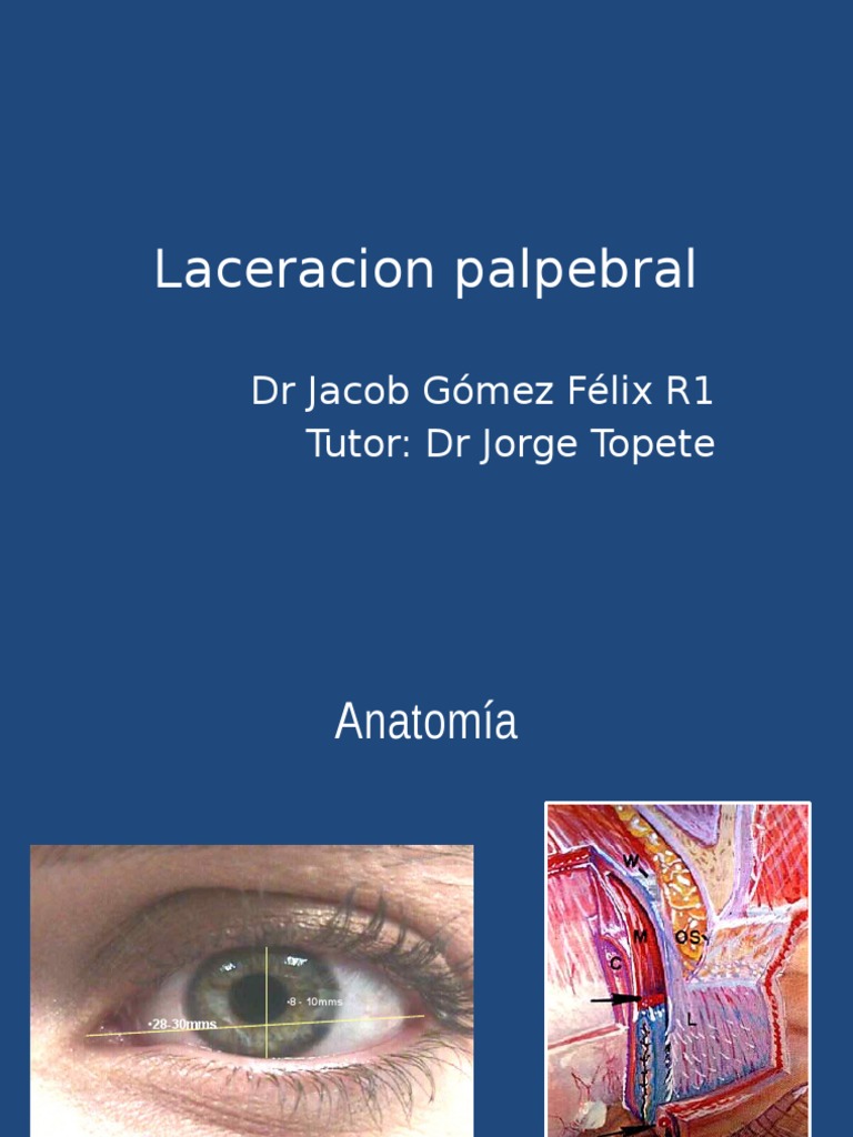 Laceracion Palpebral | PDF