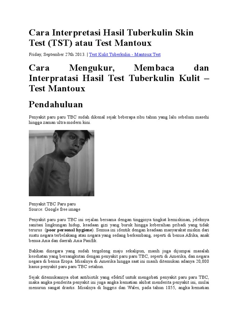 Cara Interpretasi Hasil Tuberkulin Skin Test | PDF