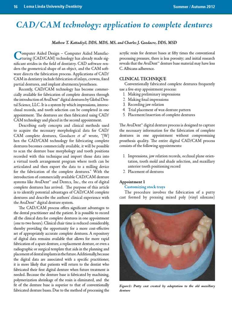 Avadent Article Loma Linda | PDF | Dentures | Dental Implant
