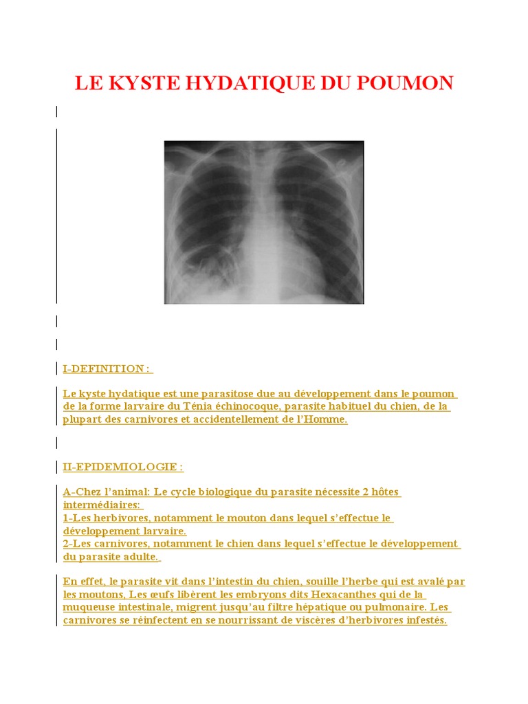 Kyste hydatique pulmonaire : diagnostic et traitement | PDF | Sciences ...