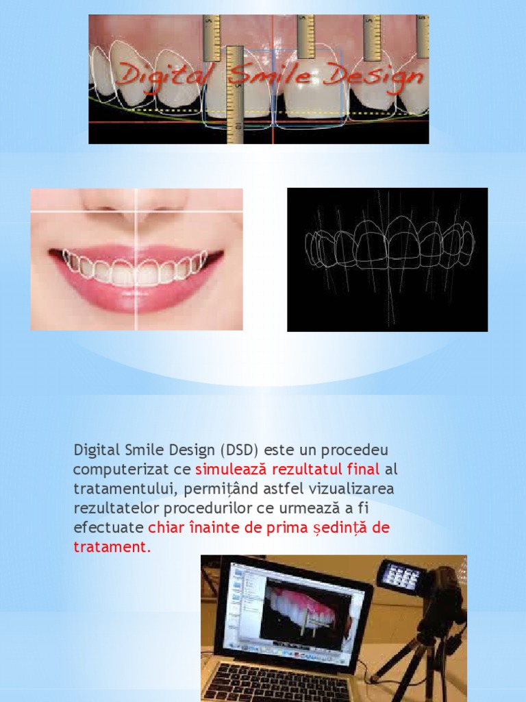 Digital Smile Design | PDF