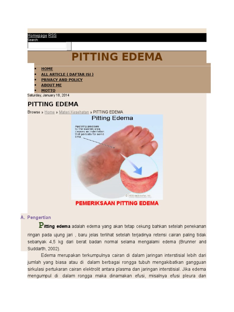 Edema Pitting Pemeriksaan | PDF