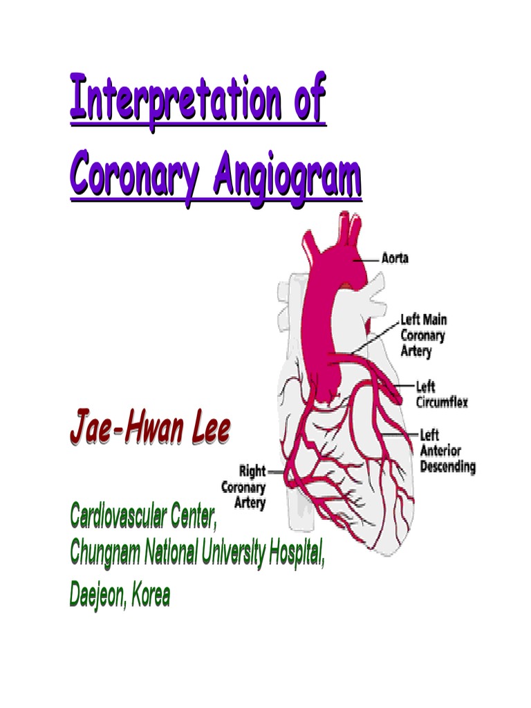 3_Interpretation of Coronary Angiogram | Coronary Circulation | Angina ...