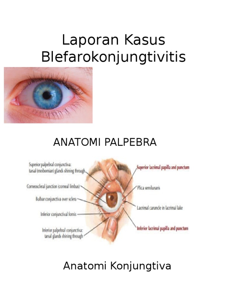 Laporan Kasus Blefarokonjungtivitis | PDF