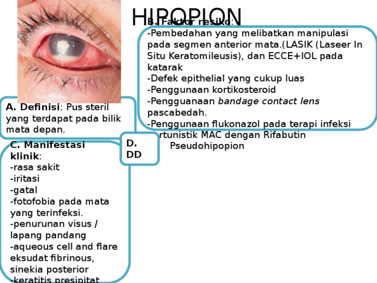 Hipopion: Gejala dan Risiko | PDF | Sains & Matematika | Teknologi ...