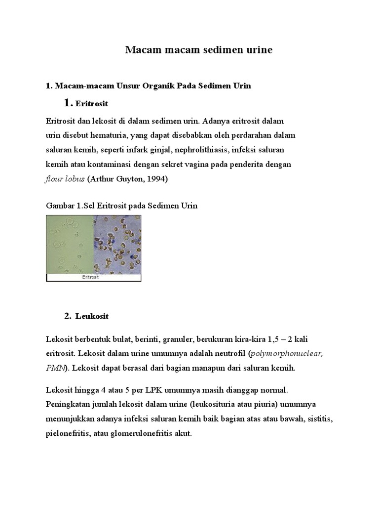 Jenis Sedimen Urine dan Analisisnya | PDF | Griya & Taman | Kesehatan ...