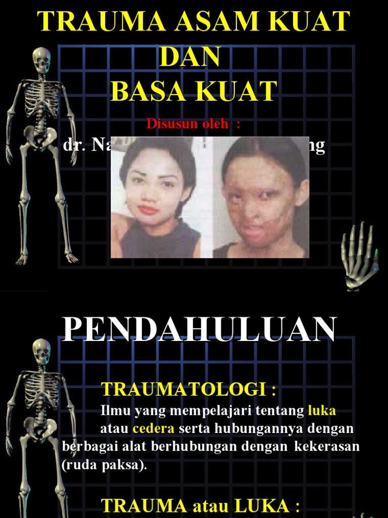 Asam Kuat Dan Basa Kuat | PDF