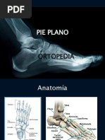 Pie Talo, Pie Varo, Valgo, y Pie Plano | PDF | Pie | Tobillo