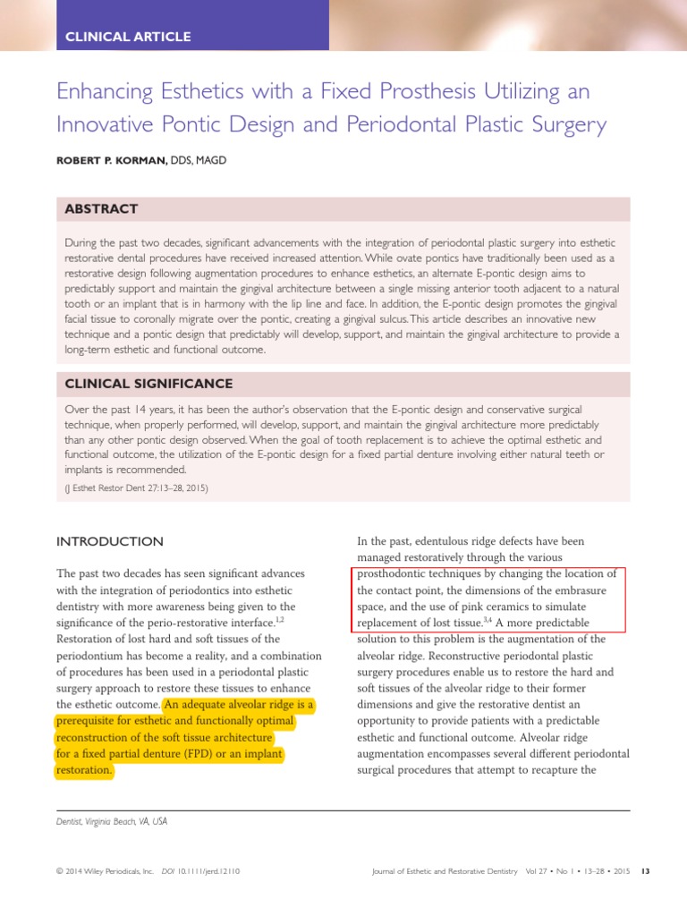 Pontico en E | Download Free PDF | Dental Implant | Dentures