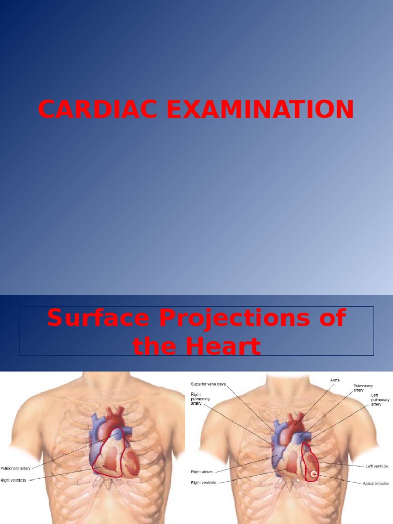 A Guide to the Cardiac Examination: Techniques for Auscultating the ...