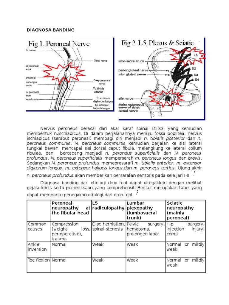 Drop Foot Differential Diagnosis | PDF